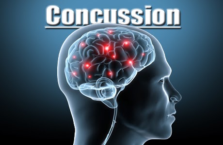 Concussion Information ~ Connecticut College Sports Medicine