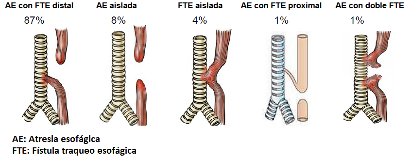 Patología : ESÓFAGO