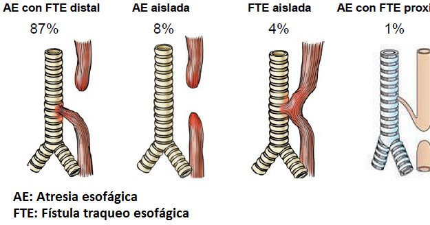 Patología : ESÓFAGO