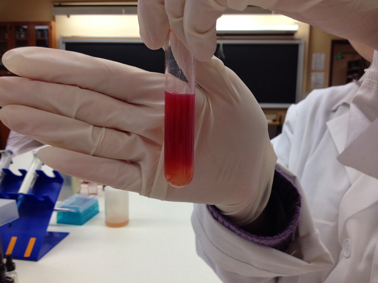 Ari And Johannas Medical Microbiology Lab Report Indole Urea Nitrate Methyl Red Citrate