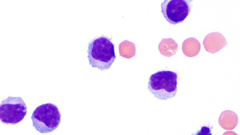 Lymphocytic pleocytosis