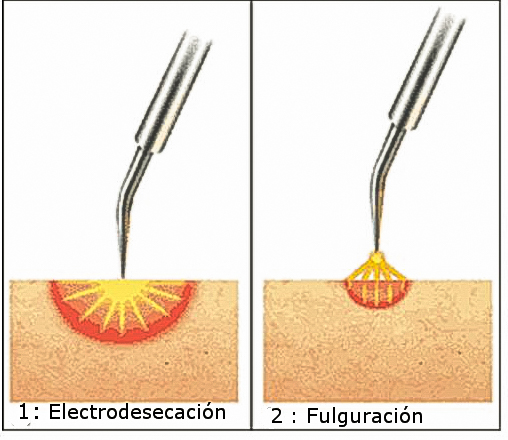 Revision Casos De Cirugia General