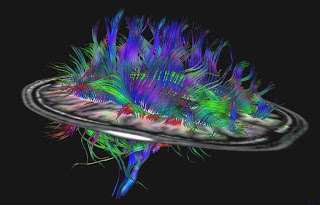 My E-MRI: Diffusion Tensor Imaging (DTI)