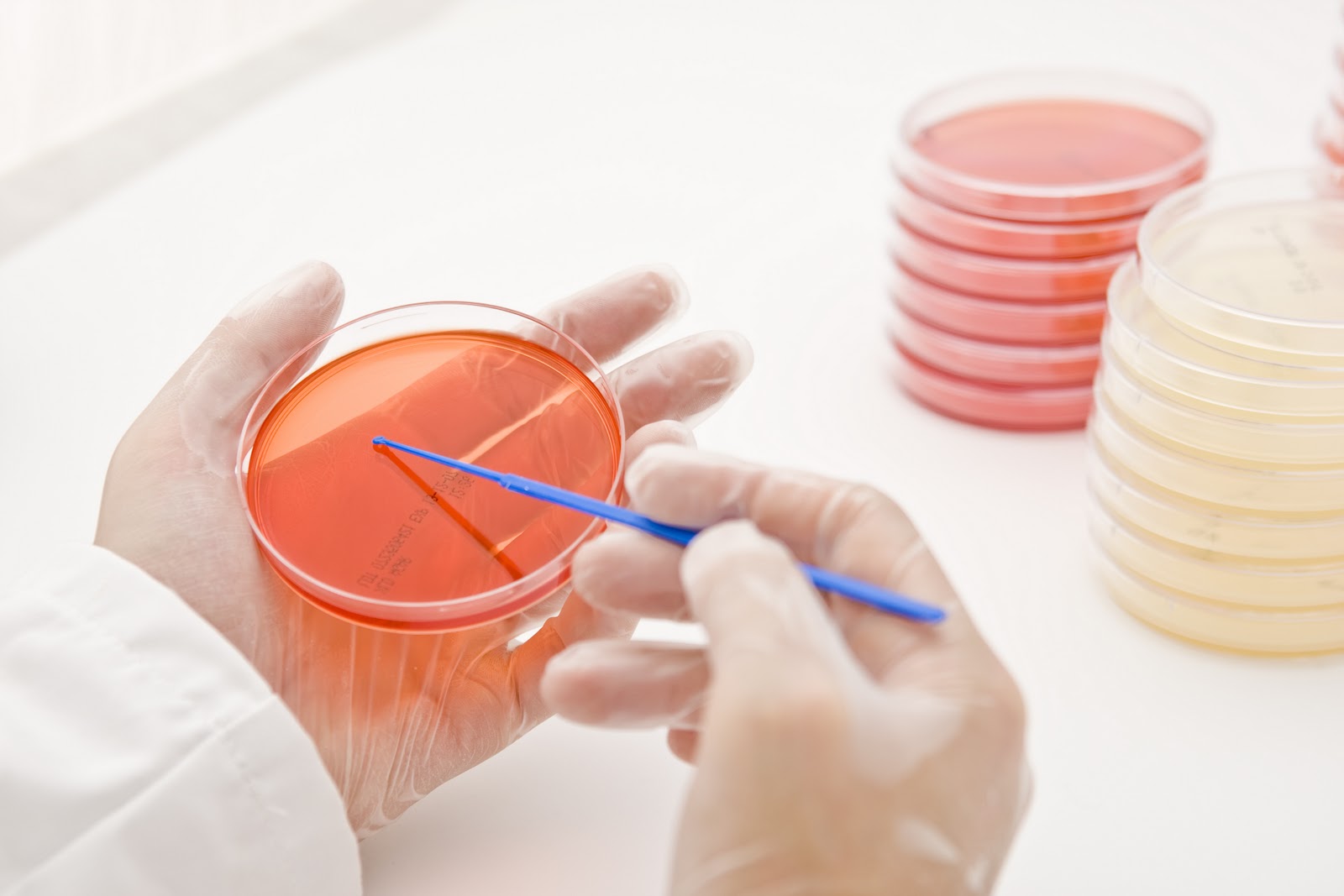 CLÍNICA DOCTORA PAEZ | DISCROMÍAS