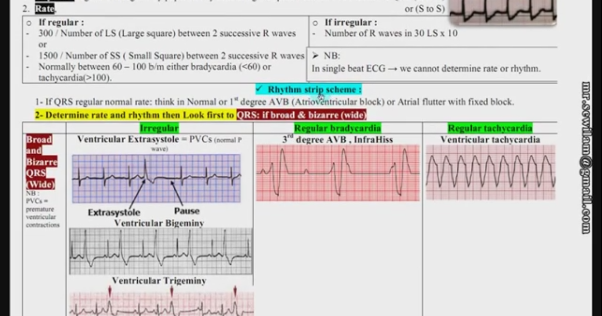 ParaClinical Made Easy : احتراف ال ECG مع الكورس الرائع للدكتور محمود ...