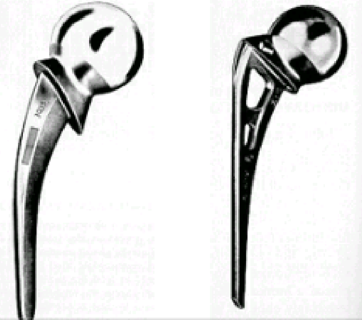 BIOMECHANICS ENGINEERING TEAM : Actualidad de Implantes de Cadera