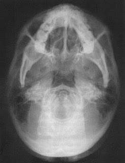 RADIOLOGIA: POSICIONAMENTO DO CRÂNIO