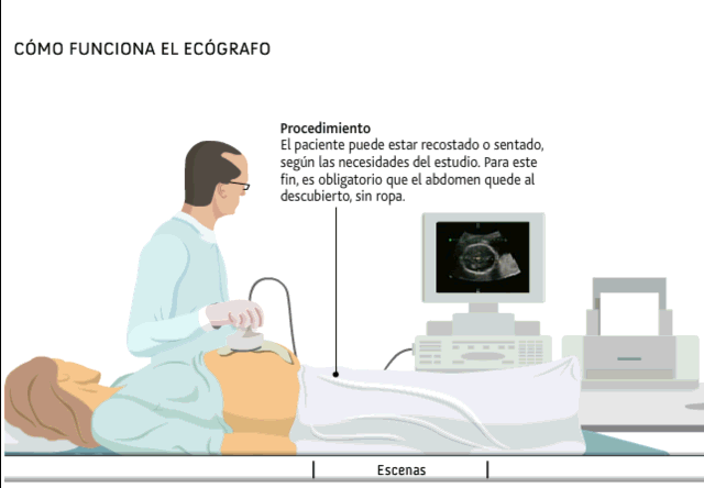 Avibert: Ecografías Infografía Salud Consumer Eroski