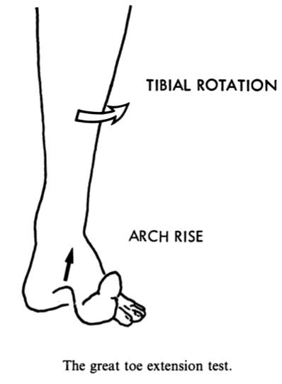 Extension Of Toes