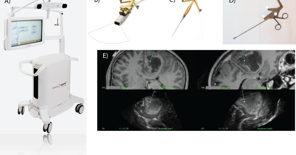 Journal and Conferences on Biomedical Engineering: An Ultrasound Based ...