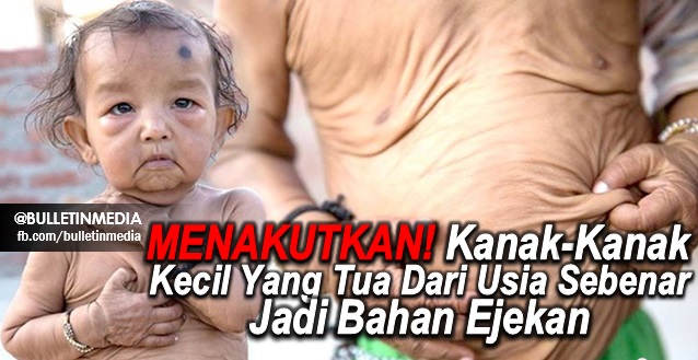 MENAKUTKAN! (GAMBAR) Kanak-Kanak Kecil Yang Tua Dari Usia Sebenar Jadi ...