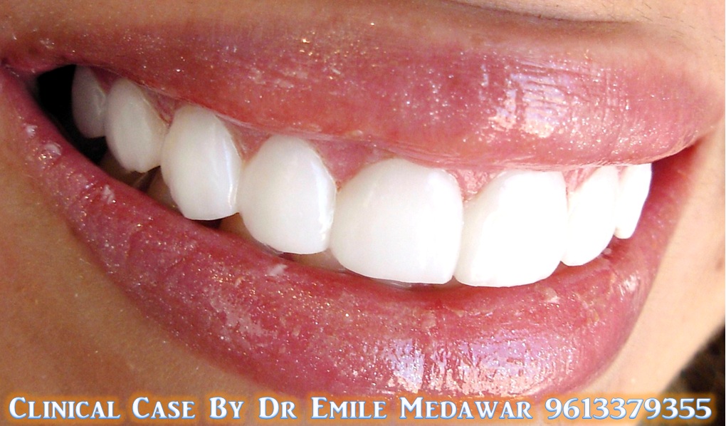 Hollywood Smile With Style, Dr Emile Medawar, Beirut Lebanon, 00 961 3 ...