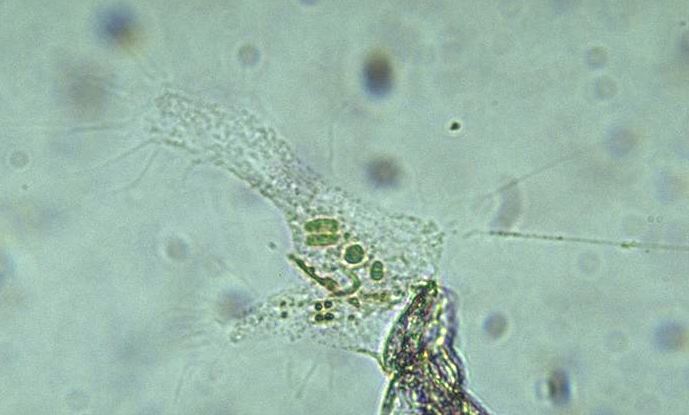 Variety of Life: Amoebozoa