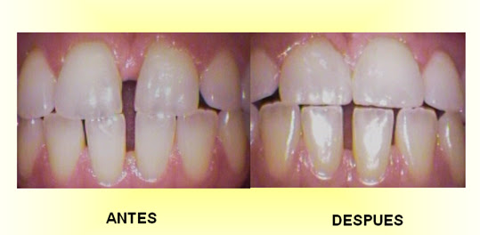 Salud y Estética Dental.