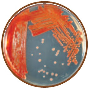 [Microbiology] Atlas of Streak Plate Methods of Isolation | Free ...