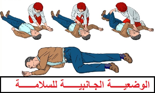 اسعاف و سلامة اسعاف مصاب بنوبة الصرع أو التشنجات بتسريح المسالك