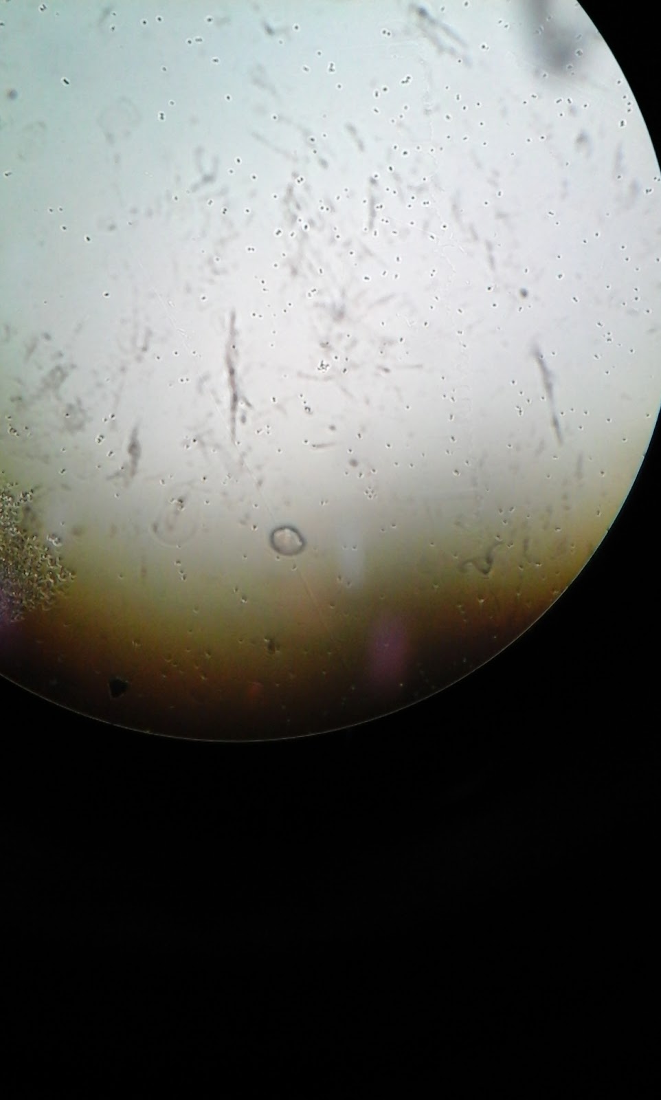 Materi Biologi: Jurnal Mikrobiologi Tentang Morfologi Dan Inokulasi ...