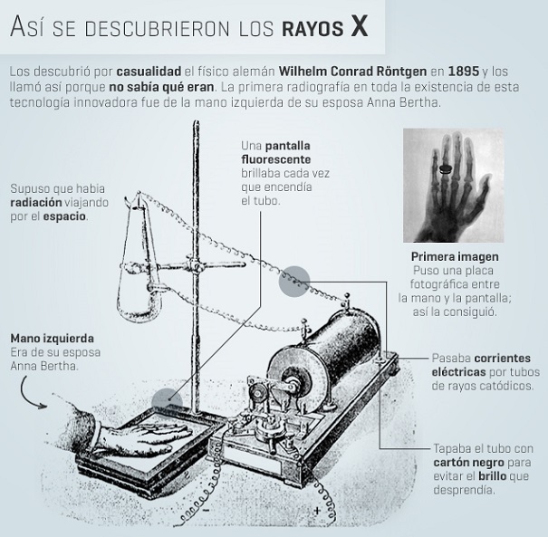 Compás Oxidado: Wilhelm Conrad Röntgen Y Rayos X
