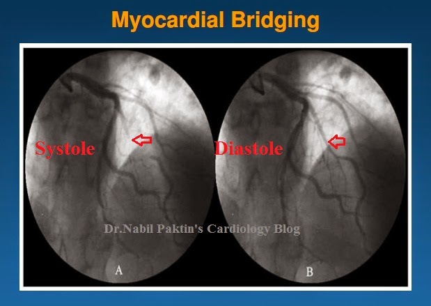 Dr.Nabil Paktin's Journal of Cardiovascular Medicine Blog ژورنال ( قلب ...