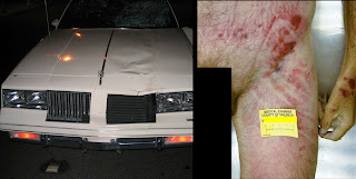 Deformutilation: Road Rash