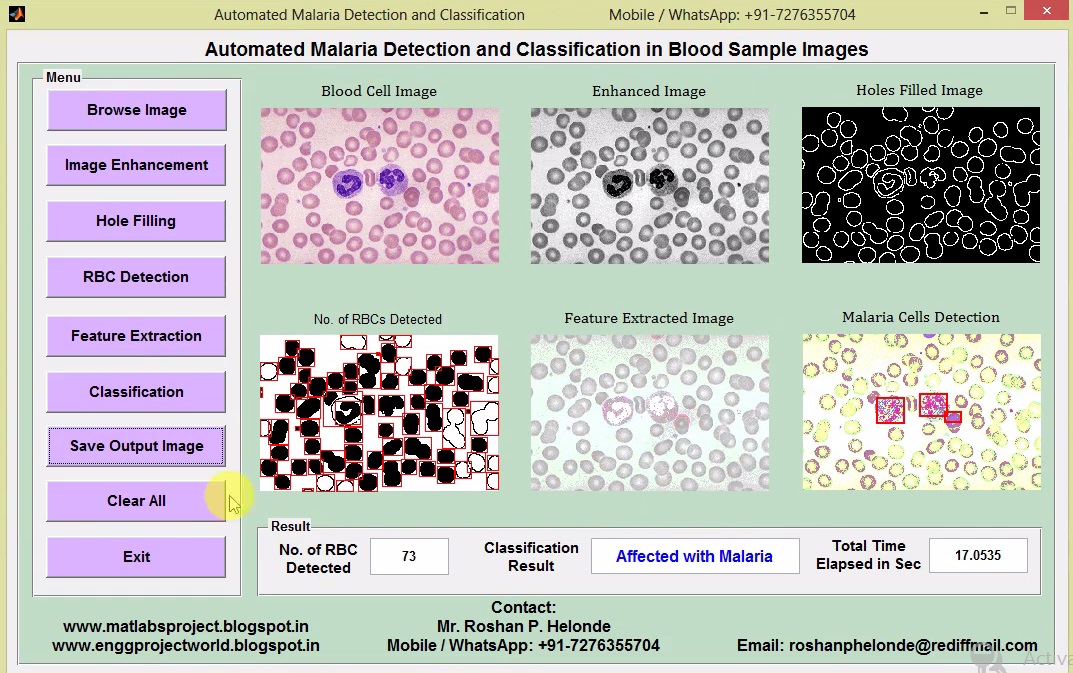 Malaria Detection in Blood Cell Images Using Image Processing Matlab Project with Source Code ...