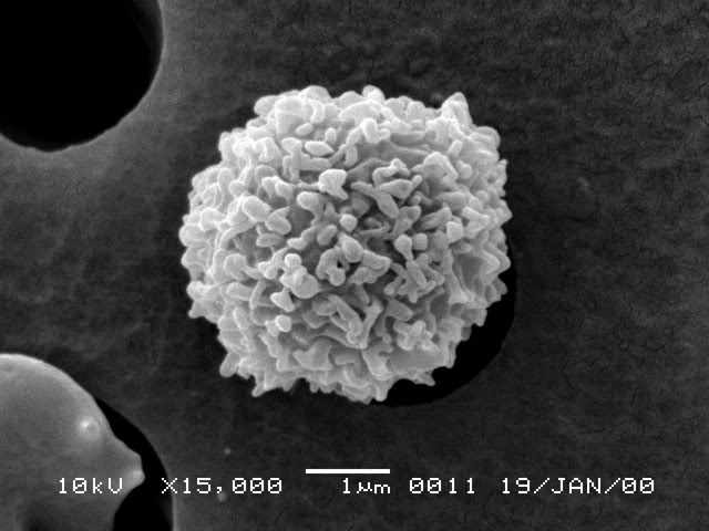 Leukosit (Sel Darah Putih) ~ Zone Makalah