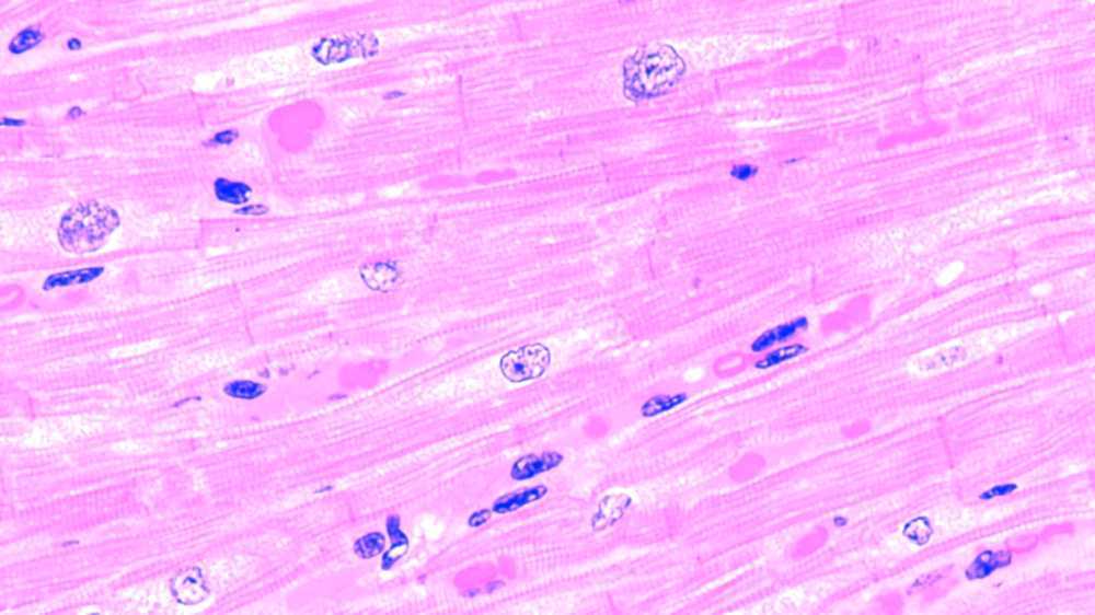 Cardiac muscle cell