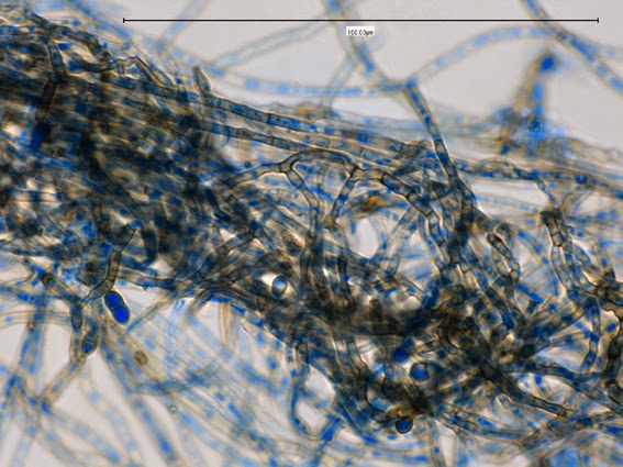 Fun With Microbiology (What's Buggin' You?): Ochroconis species