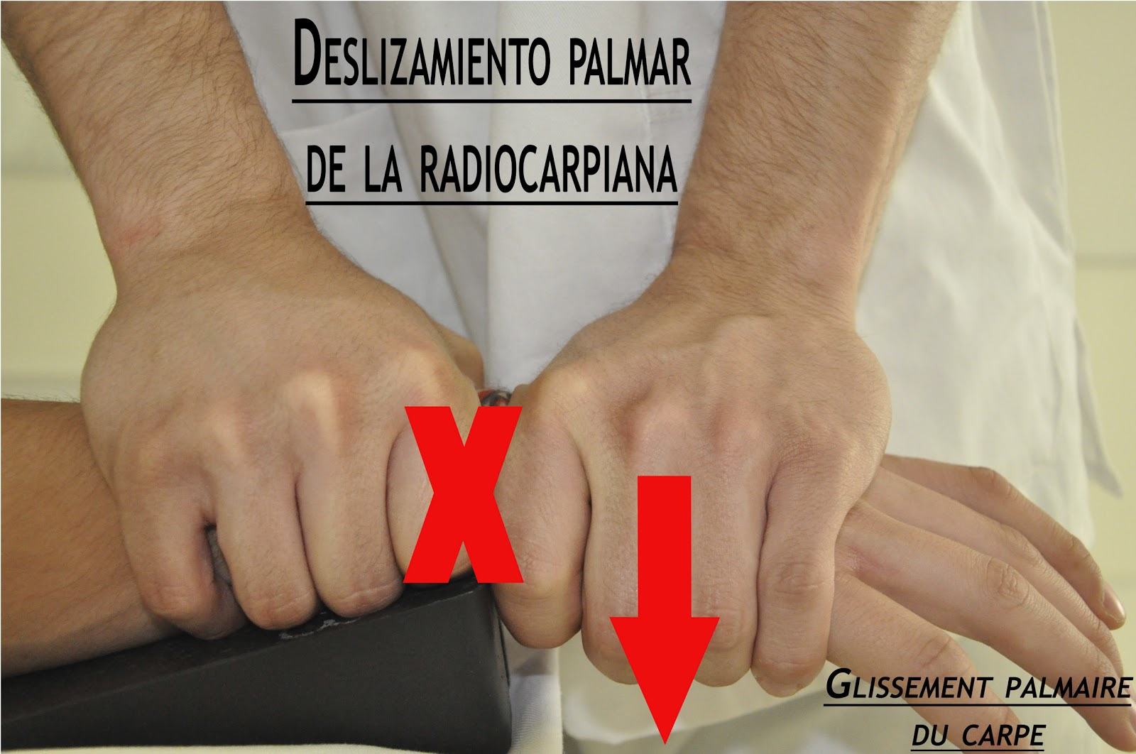 Érase una vez..tu radiocarpiana y sus huesitos: La radiocarpiana...eso ...
