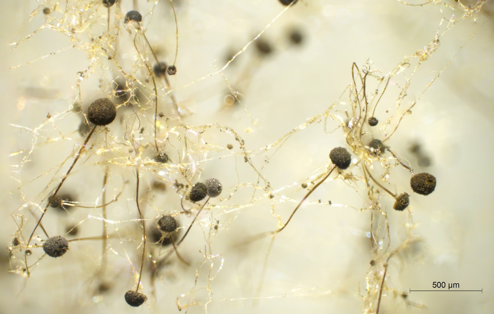 Bread Mold Under Microscope