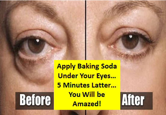 Apply Baking Soda Under Your Eyes… 5 Minutes Latter… You Will be Amazed ...
