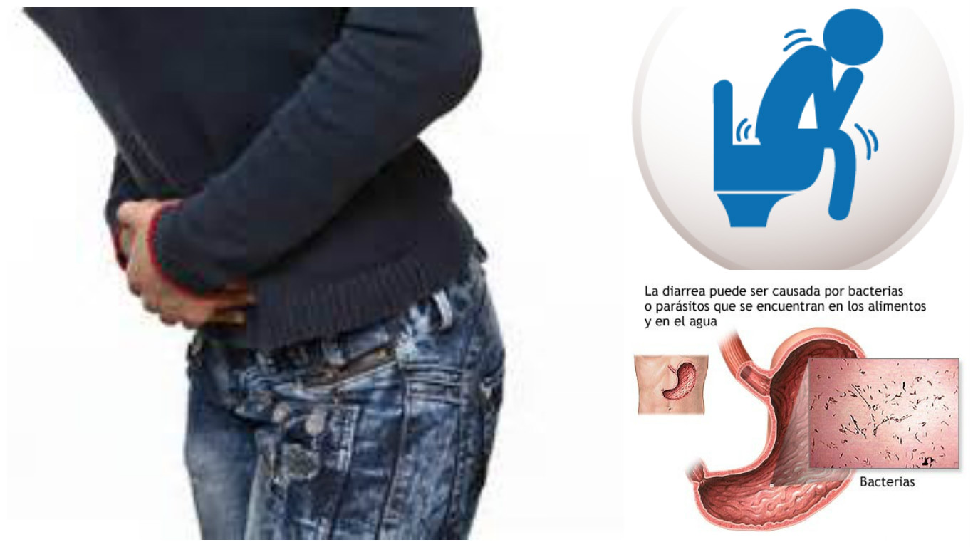 ¿CÓMO CURAR LA INFECCIÓN INTESTINAL? (REMEDIOS CASEROS)