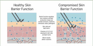 SKIN BARRIER - Talk about Skincare