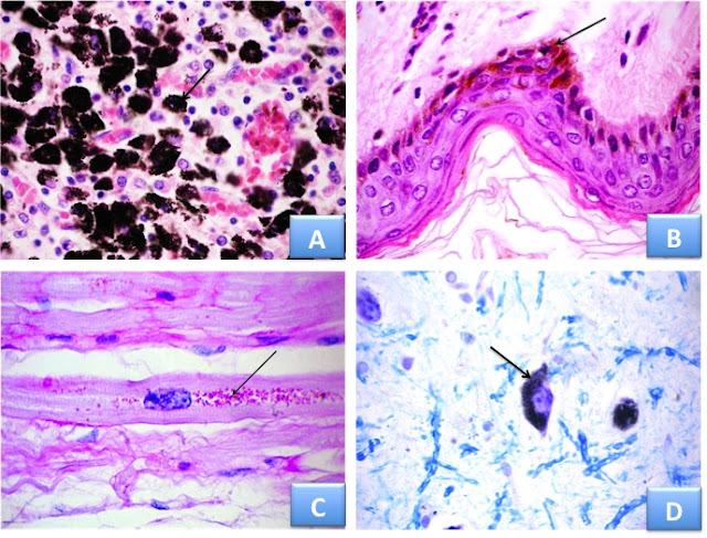 SOS BIOLOGIA CELULAR Y TISULAR: INCLUSIONES. PIGMENTOS. Inclusions ...