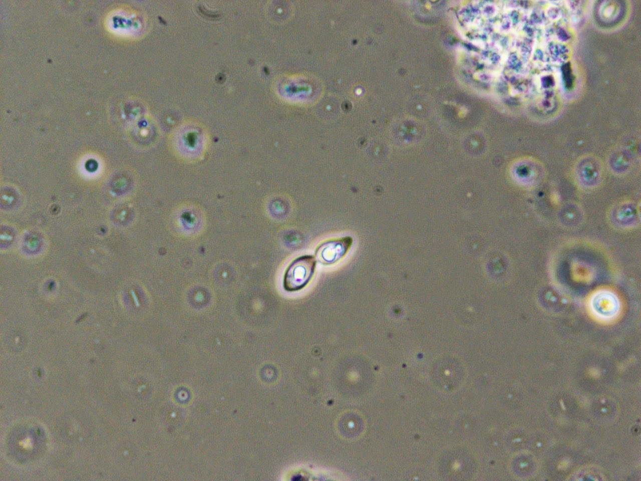 Bee Bugs: "Mystery Spores" in Bee Macerates