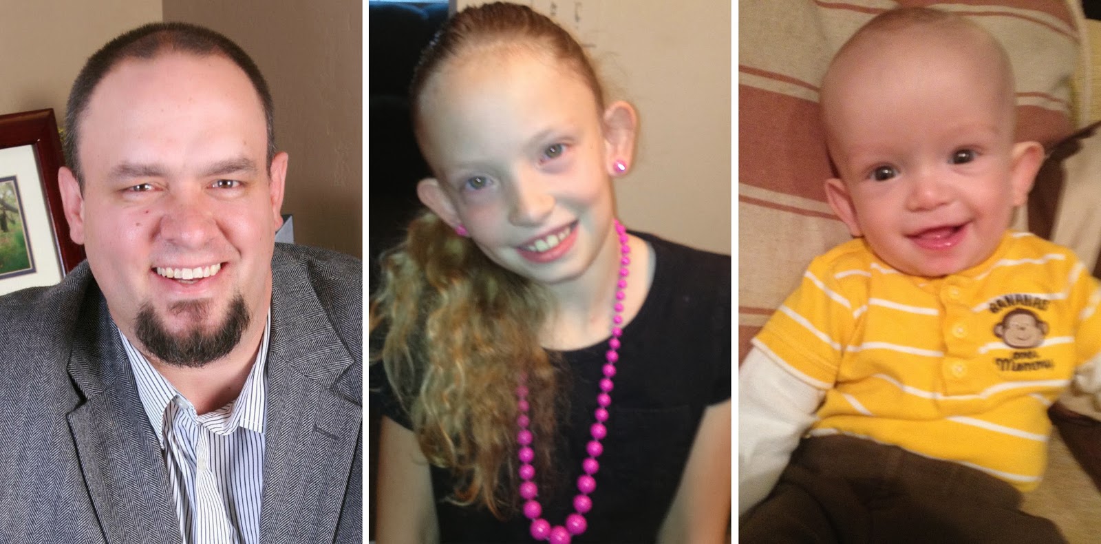 Embracing Life's Adventures: Marks and Finlay Syndrome (Scalp, Ear, and ...