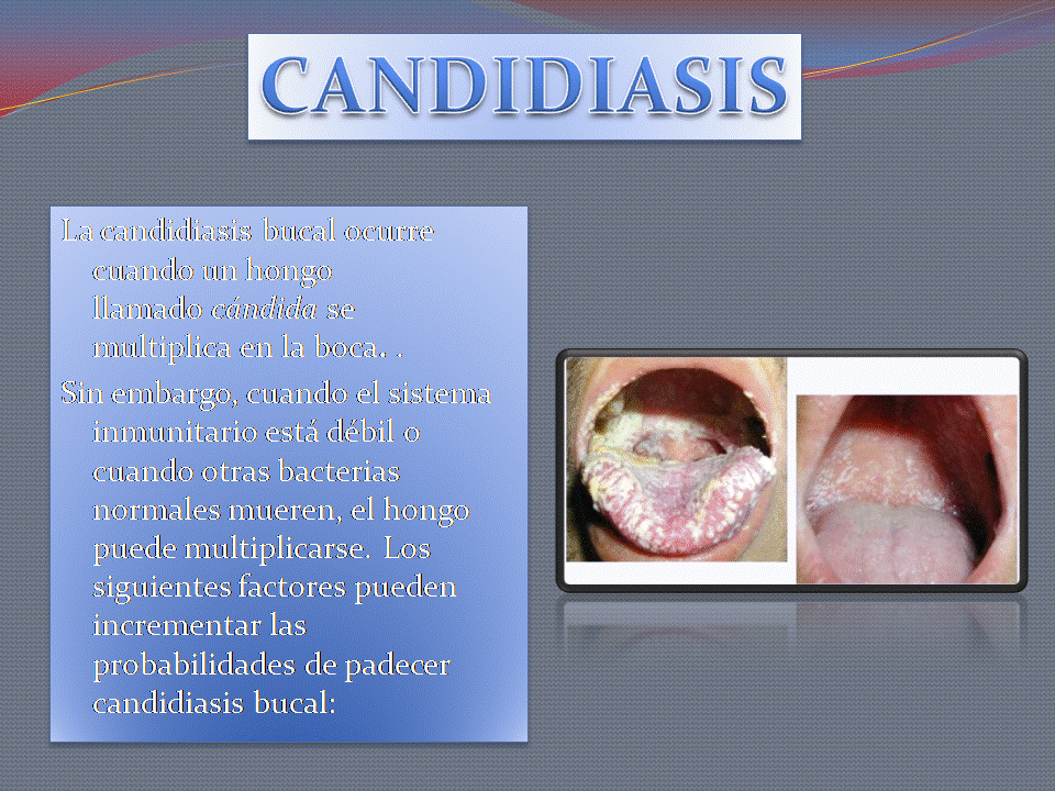 INFECCIONES: INFECCIÓN POR HONGOS