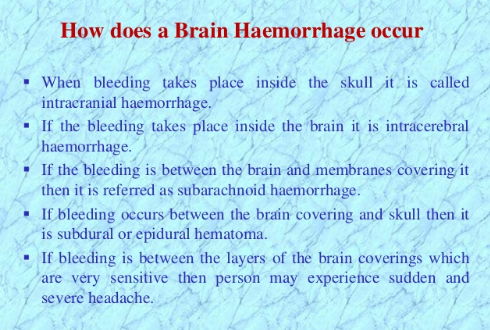Brain hemorrhage symptoms and treatments - Life style and Fitness