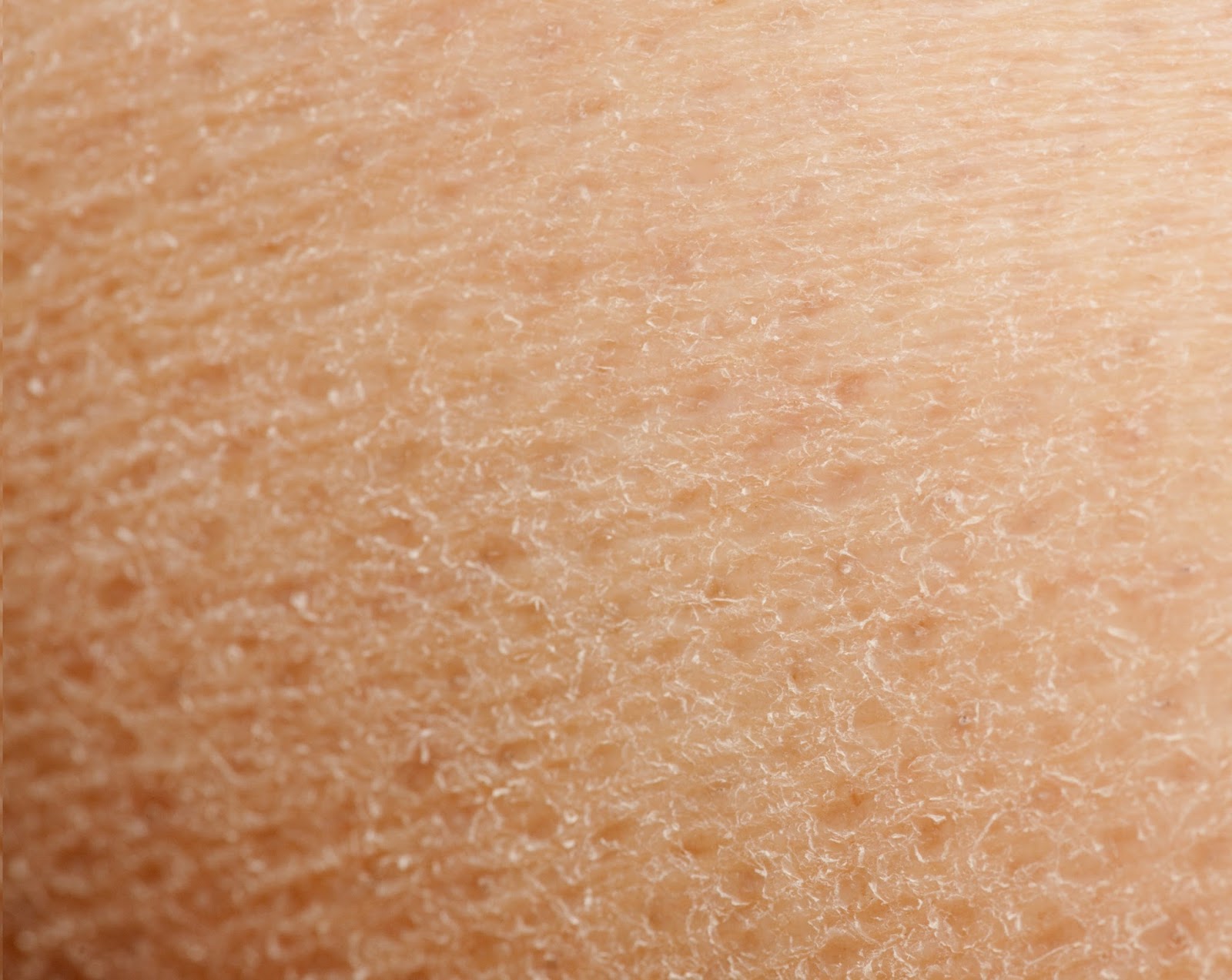 Pele seca ou desidratada?