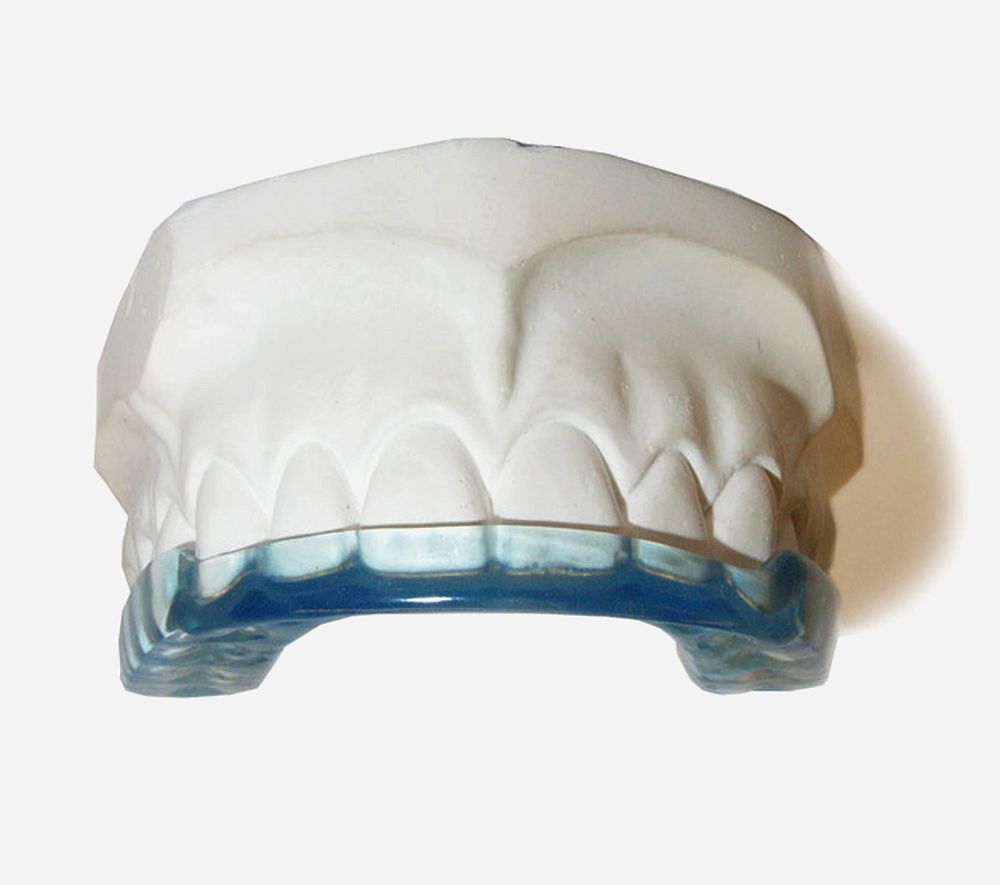 Que es una férula de descarga? Indicaciones y Consejos - Directorio ...