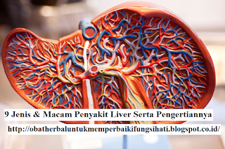 9 Jenis & Macam Penyakit Liver Serta Pengertiannya ~ Obat Herbal Untuk ...