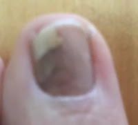 Runderdog: Runleashed and Runstoppable: Marathon recovery: Let's talk ...