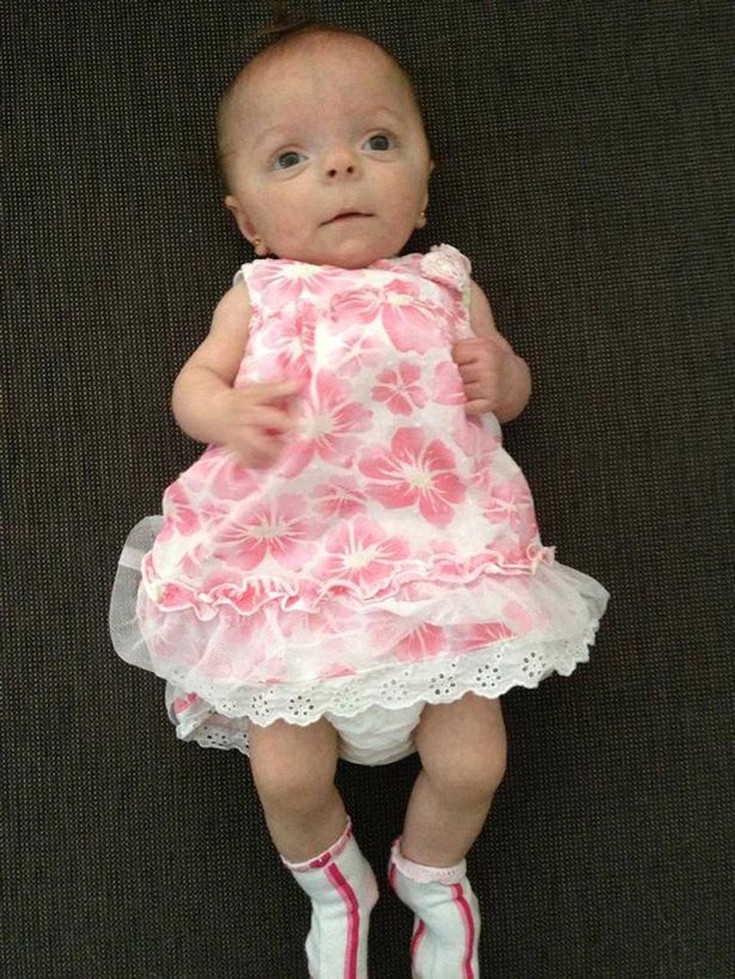 See the most tiny four-year-old! When he was born he was smaller than a ...