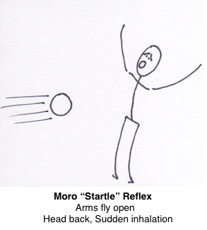 Whole-Brain Living and Learning: Resolving Moro - the "Startle" Reflex
