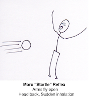Whole-Brain Living and Learning: Resolving Moro - the "Startle" Reflex