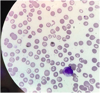 Hematologia Clínica : Atlas de Hematologia