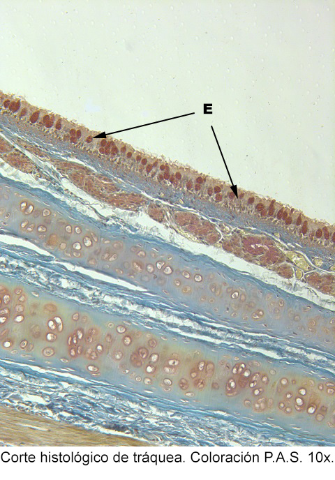 Manual interactivo de tejido epitelial: EPITELIO GLANDULAR EXOCRINO ...