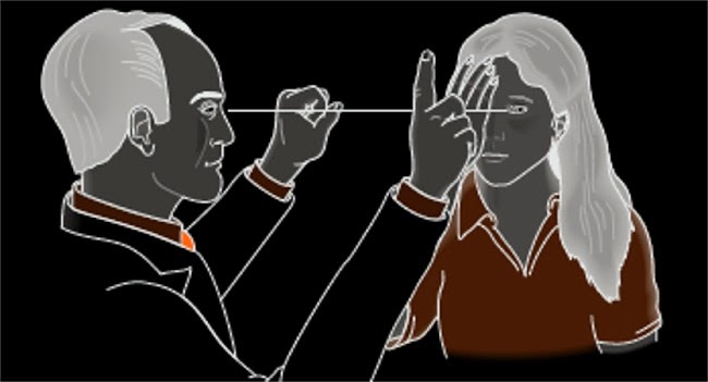 Pemeriksaan Klinis Neurologi: Pemeriksaan saraf mata