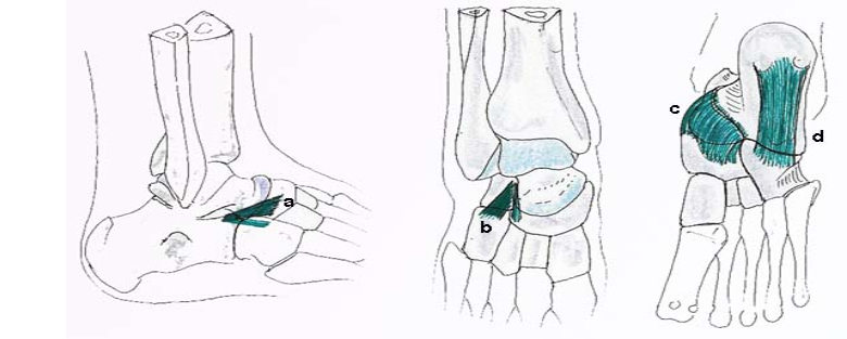 Un médecin du sport vous informe: Entorses et autres traumatismes ...