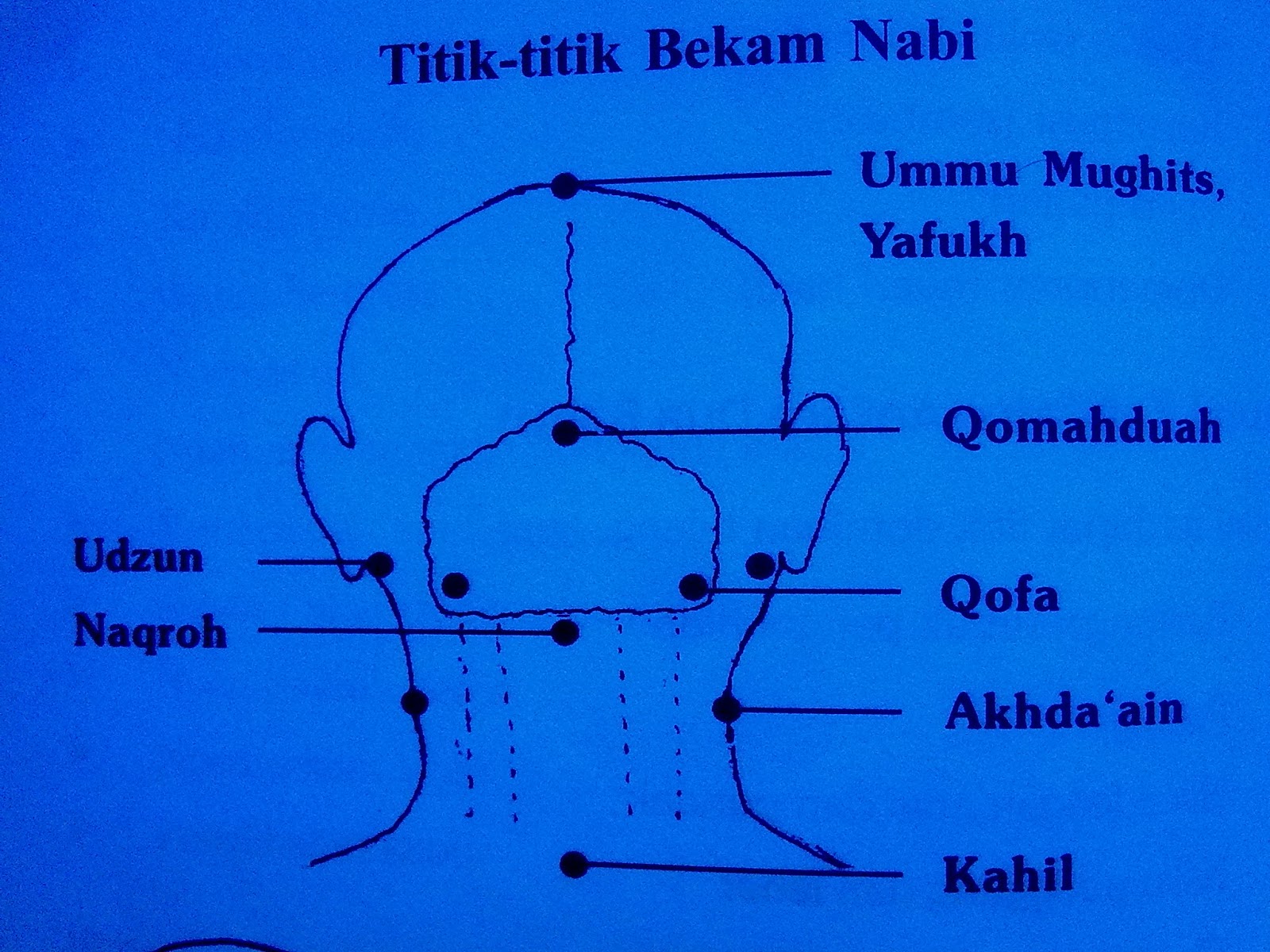 praktek bekam ala nabi: Titik bekam Rosululloh